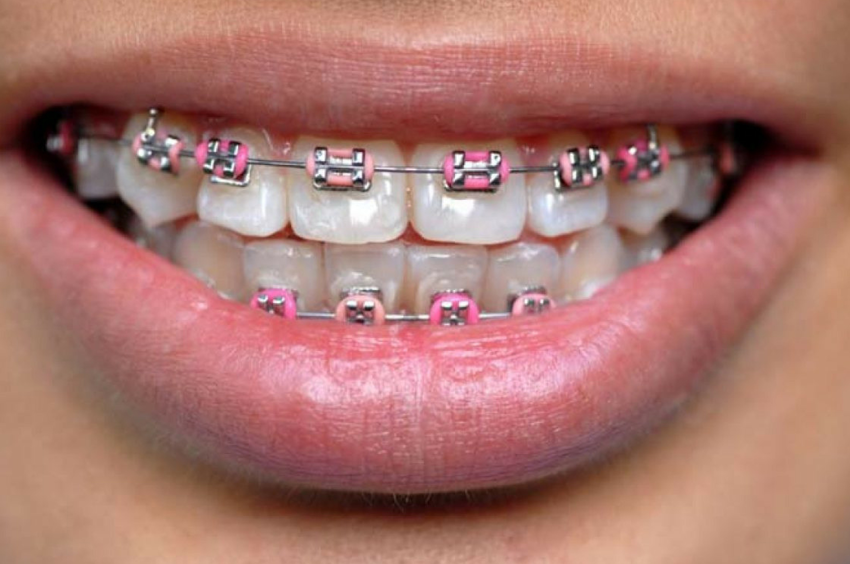 Ortodoncia Alianza Dental MX